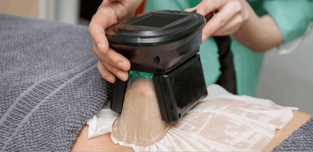 Your Guide to Fat-Freezing: Why Choose CoolSculpting Over Kybella ...